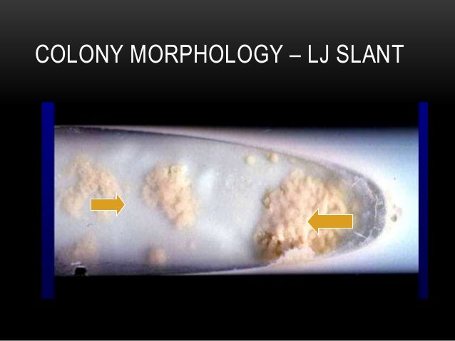 Pharmacotherapy of TUBERCULOSIS