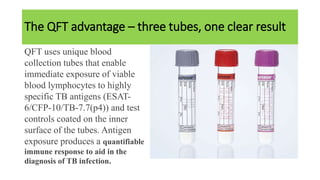 TB- QUANTIFERON TEST.pptx