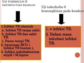 tuberkulosis Anak | PPTX