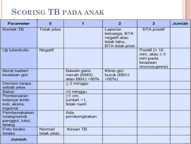 tuberkulosis Anak