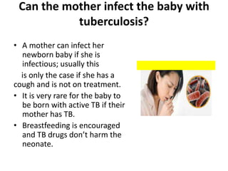 Tb and pregnancy | PPTX