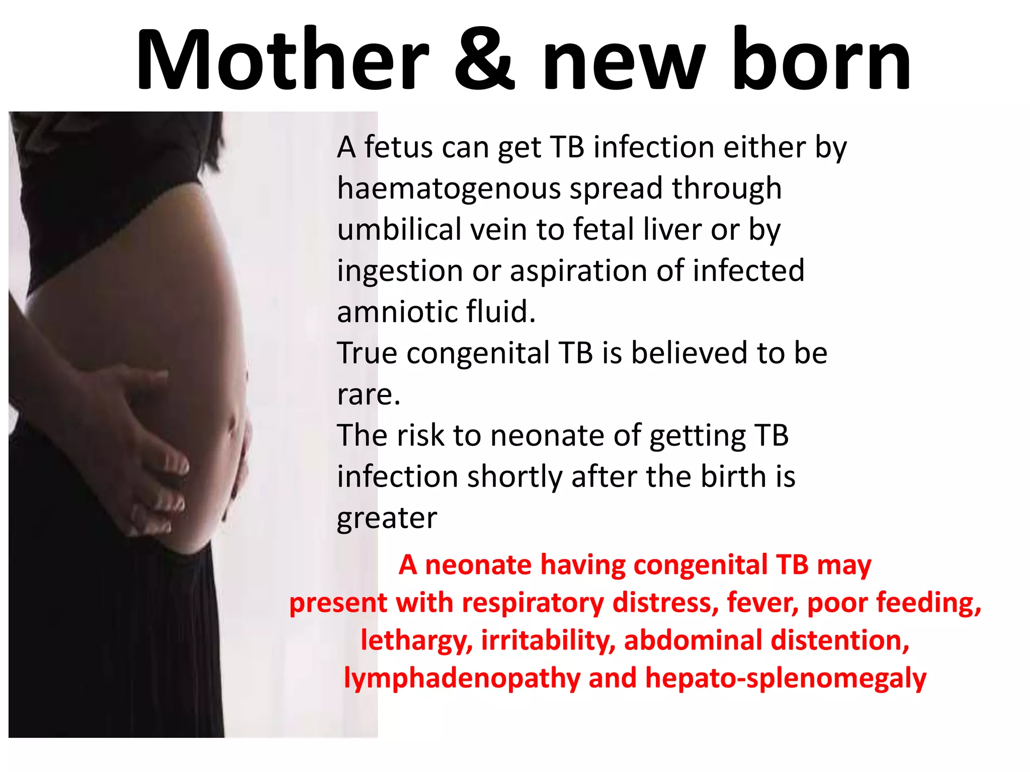 TUBERCULOSIS IN PREGNANCY | PPTX