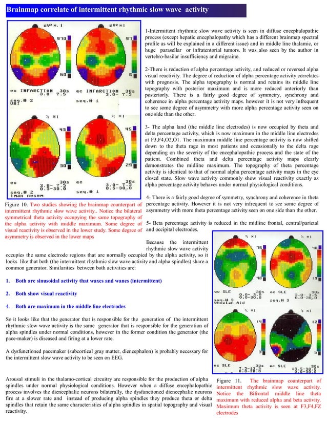 Issues in brainmapping...Textbook of brainmapping | PDF