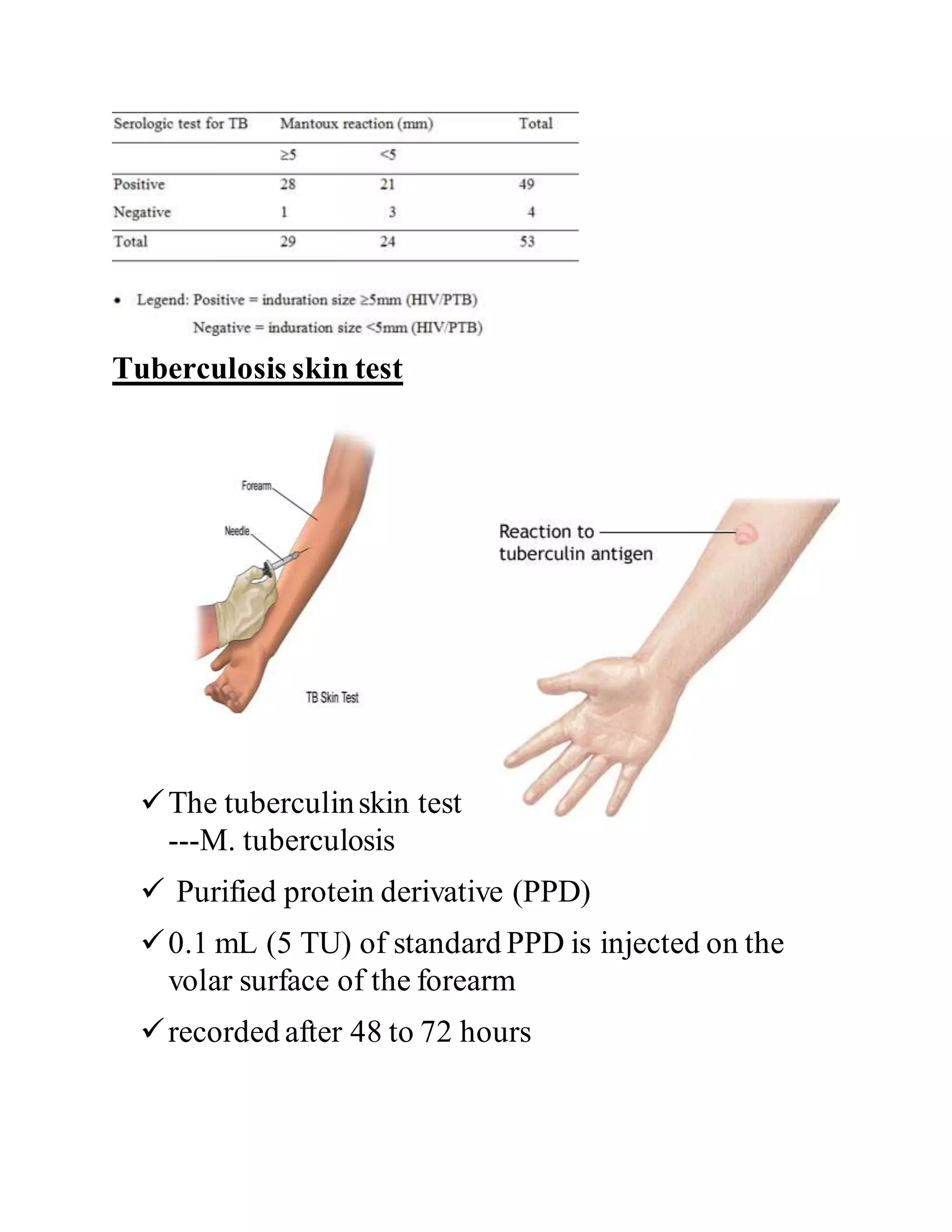 Tuberclosis | DOCX