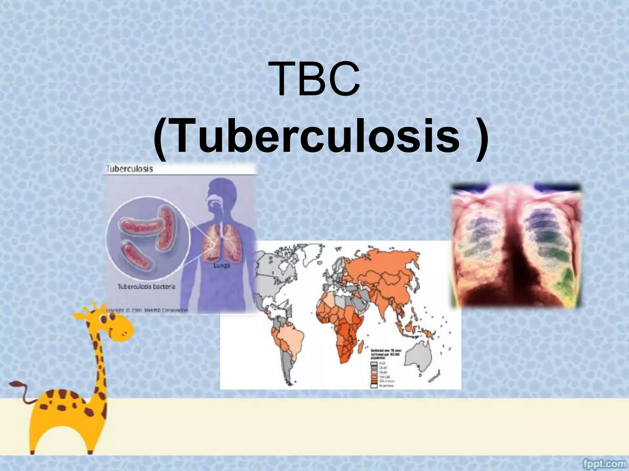 Tuberculosis (TBC) | PPTX