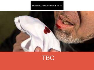 TBC.ppt