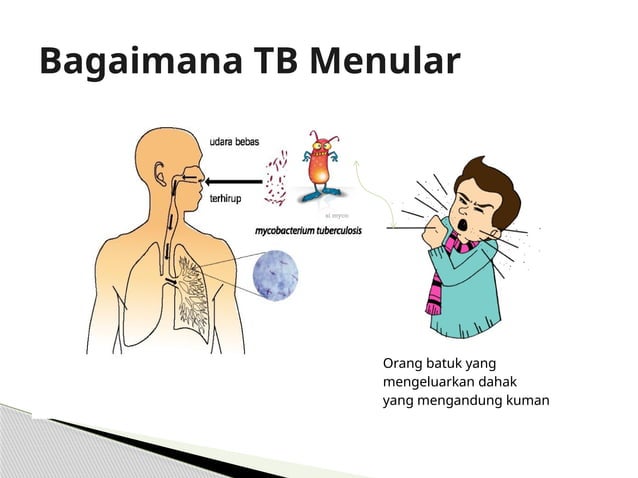 penemuan kasus tuberculosis sedidni mungkin | PPT
