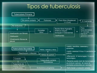 TBC.ppt diagnóstico y tratamiento de tuberculosis | PPT
