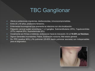 Tbc en orl | PPTX