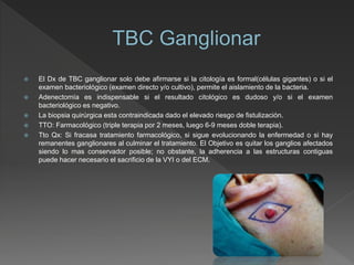 Tbc en orl | PPTX