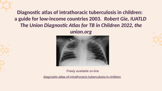 Tuberkulosis Pada Anak dan tatalaksana TB pada Anak | PPTX