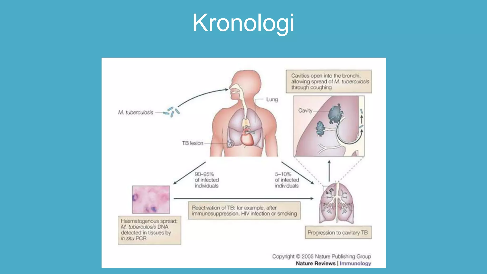 TBC Patofisiologi Penyakit Menular | PPTX