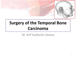 Temporal Bone Carcinoma | PPTX