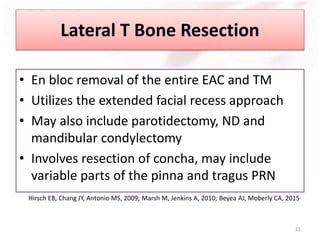 Temporal Bone Carcinoma | PPTX