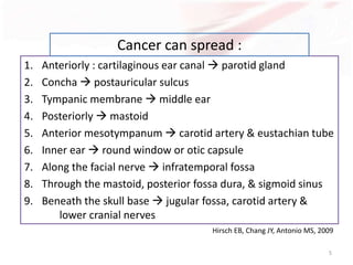 Temporal Bone Carcinoma | PPTX