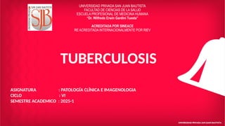 TBC(TUBERCULOSIS) TEORIA 2024-MOIMA.pptx