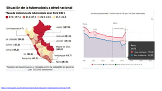 TBC(TUBERCULOSIS) TEORIA 2024-MOIMA.pptx