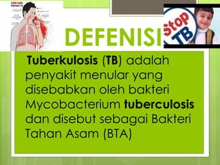 TBC (TUBERCULOSIS) PRESENTASI.pdf