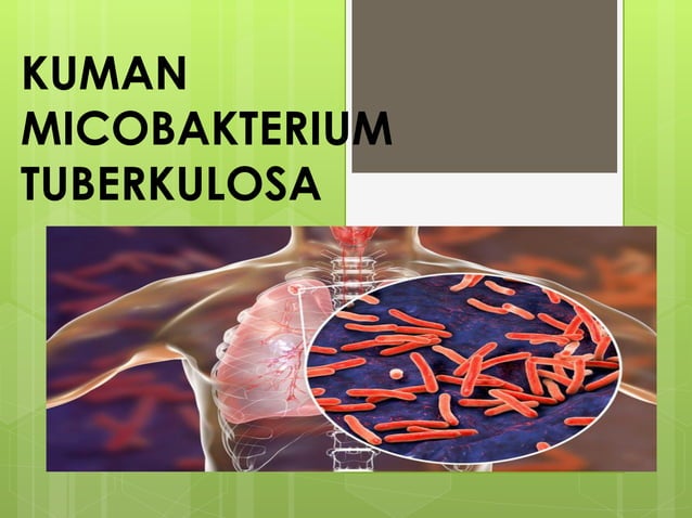 TBC (TUBERCULOSIS) PRESENTASI.pdf