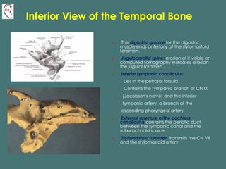 Temporal Bone Dissection :Anatomy.Technique.Surgical Precision | PDF