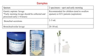 Laboratory diagnosis of Tuberculosis (Pulmonary and extra pulmonary ...