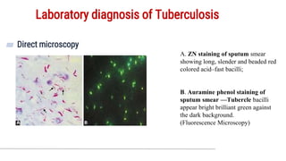 Laboratory diagnosis of Tuberculosis (Pulmonary and extra pulmonary Tuberculosis) | PPT