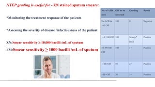 Laboratory diagnosis of Tuberculosis (Pulmonary and extra pulmonary ...