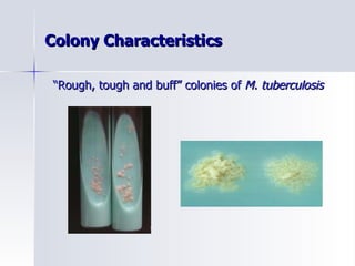 Tb diagnosis | PPT