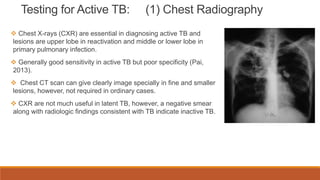 TB Diagnosis (Latent and Active). | PPTX