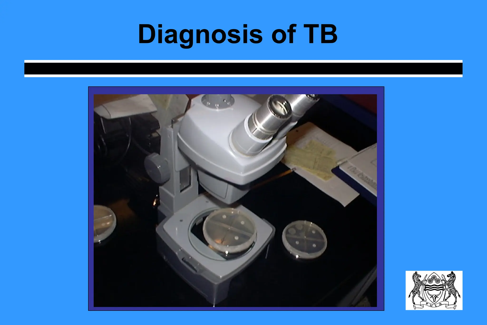 TB Diagnosis.ppt microbiology, biotechnology | PPT