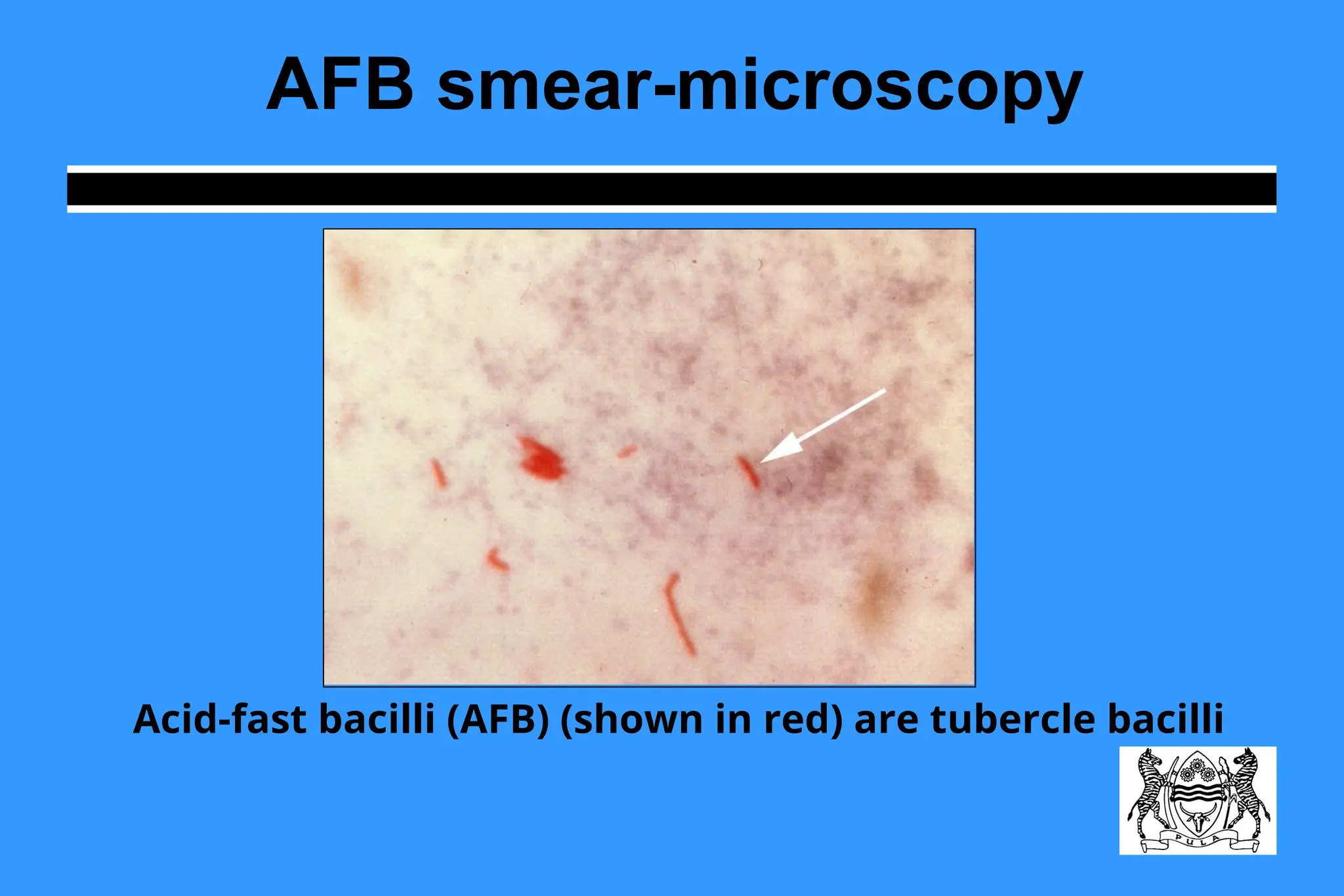 TB Diagnosis.ppt microbiology, biotechnology | PPT