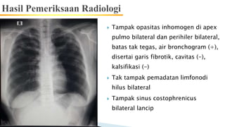Tb duplex lama aktif | PPTX
