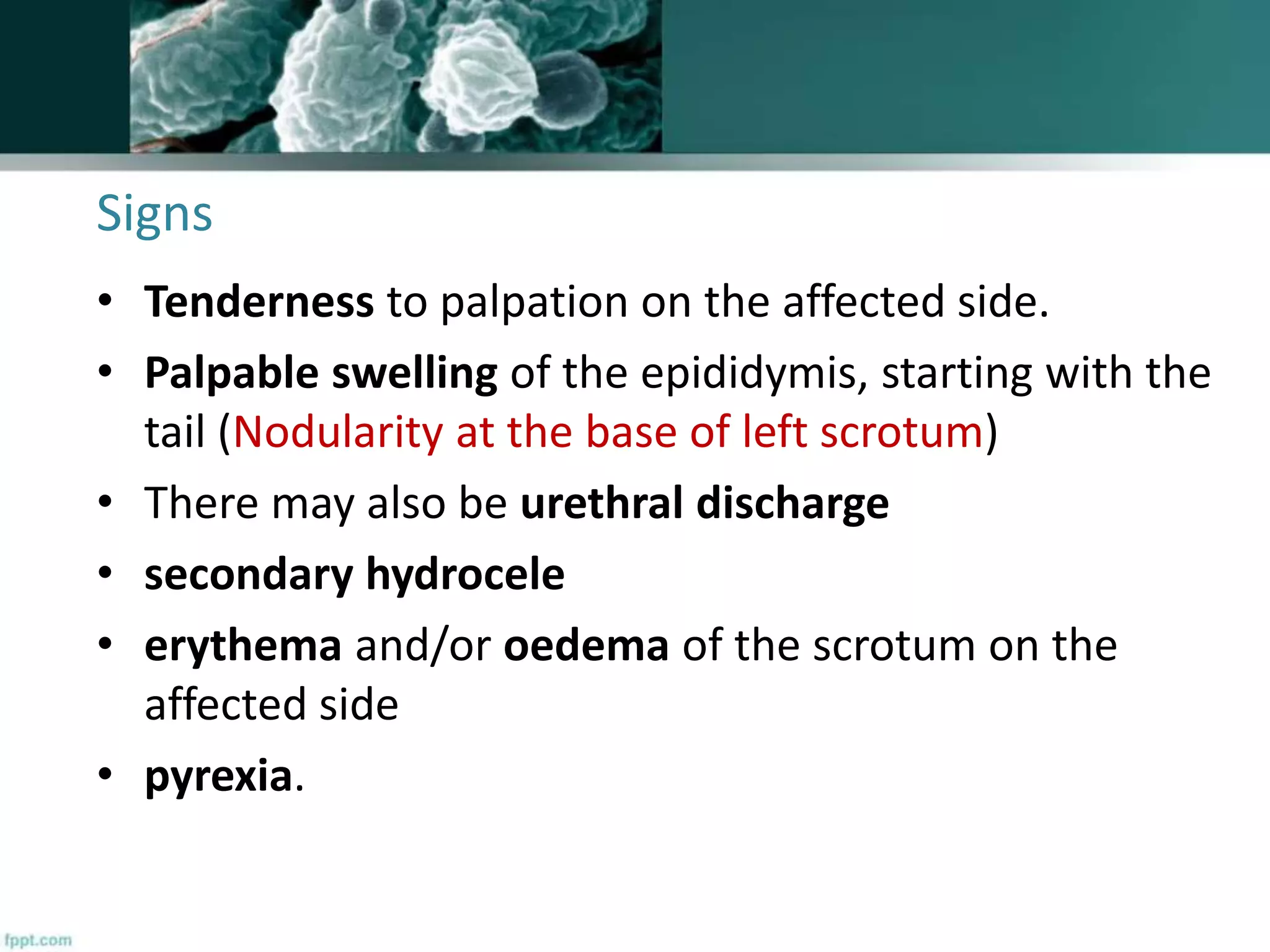 Tb epididymitis, By Emad M.Qasem | PPT