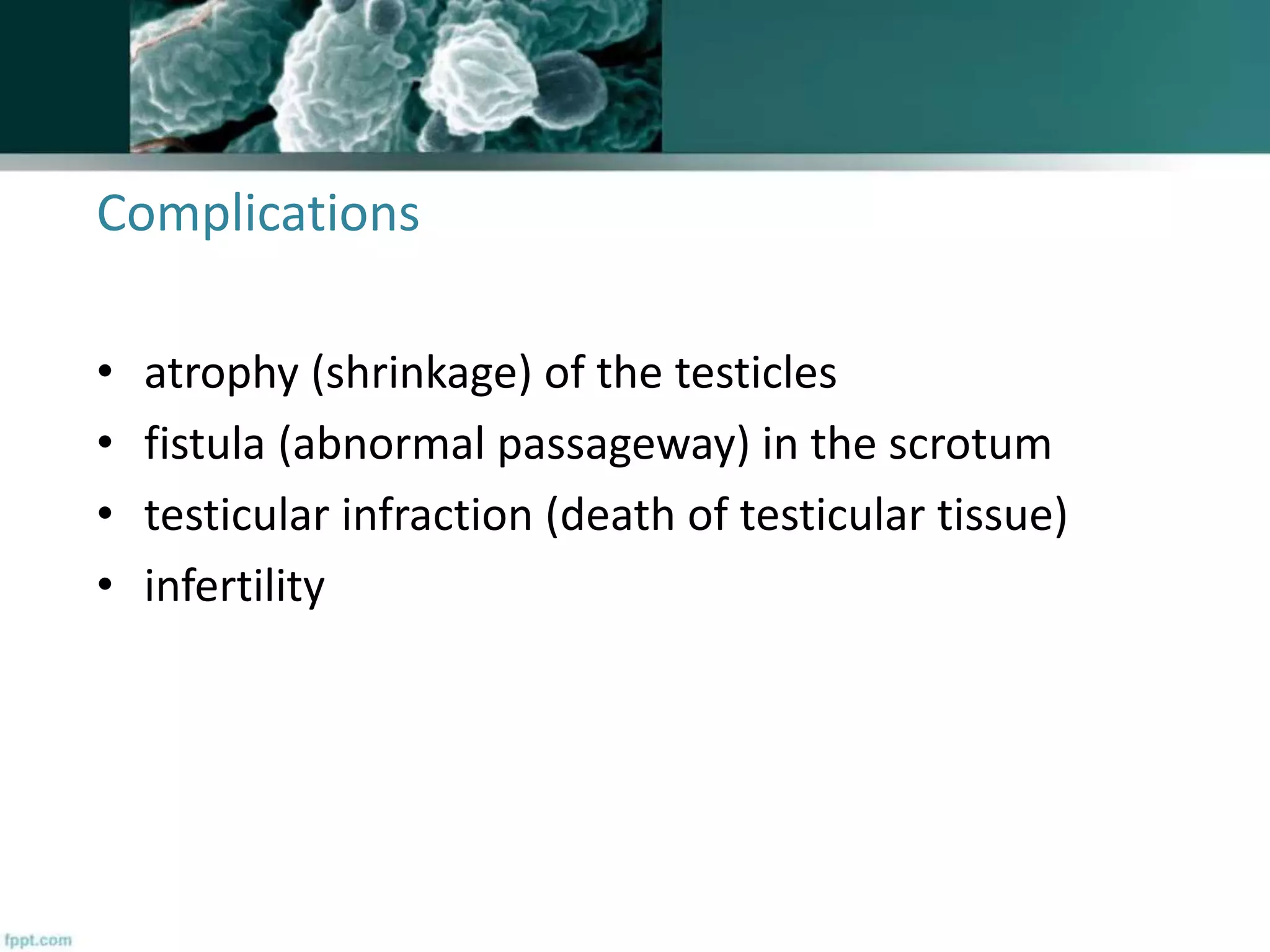 Tb epididymitis, By Emad M.Qasem | PPT