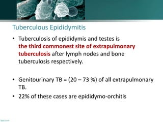 Tb epididymitis, By Emad M.Qasem | PPSX