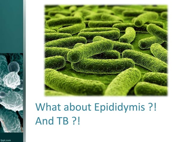 Tb epididymitis, By Emad M.Qasem | PPT