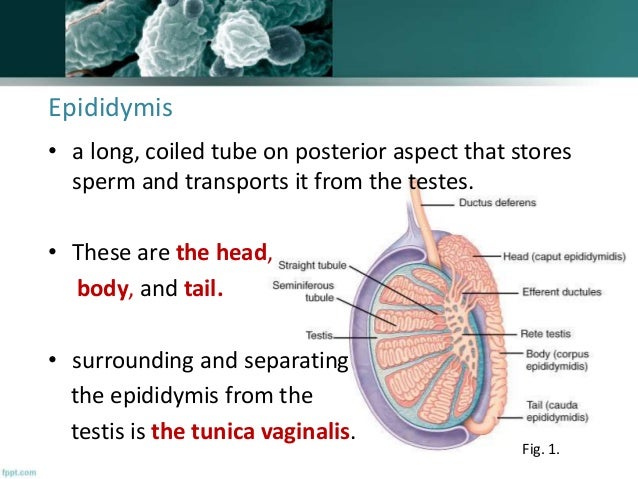 Tb epididymitis, By Emad M.Qasem
