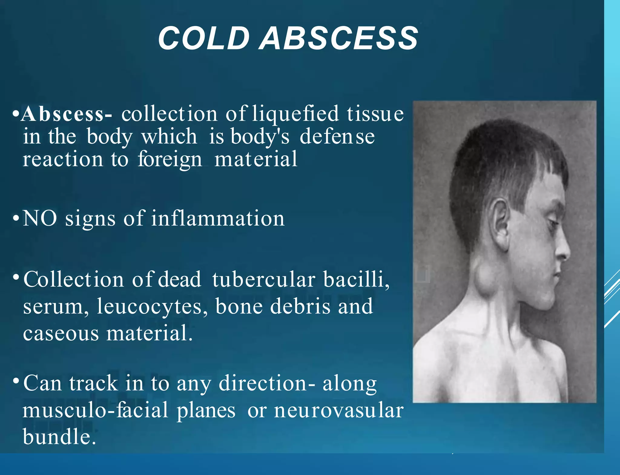 TB & fungal infection of the spine adnan al bannna | PPTX | Bone and ...