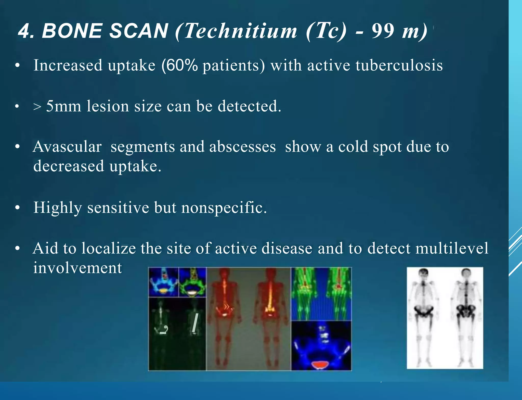 TB & fungal infection of the spine adnan al bannna | PPTX | Bone and ...