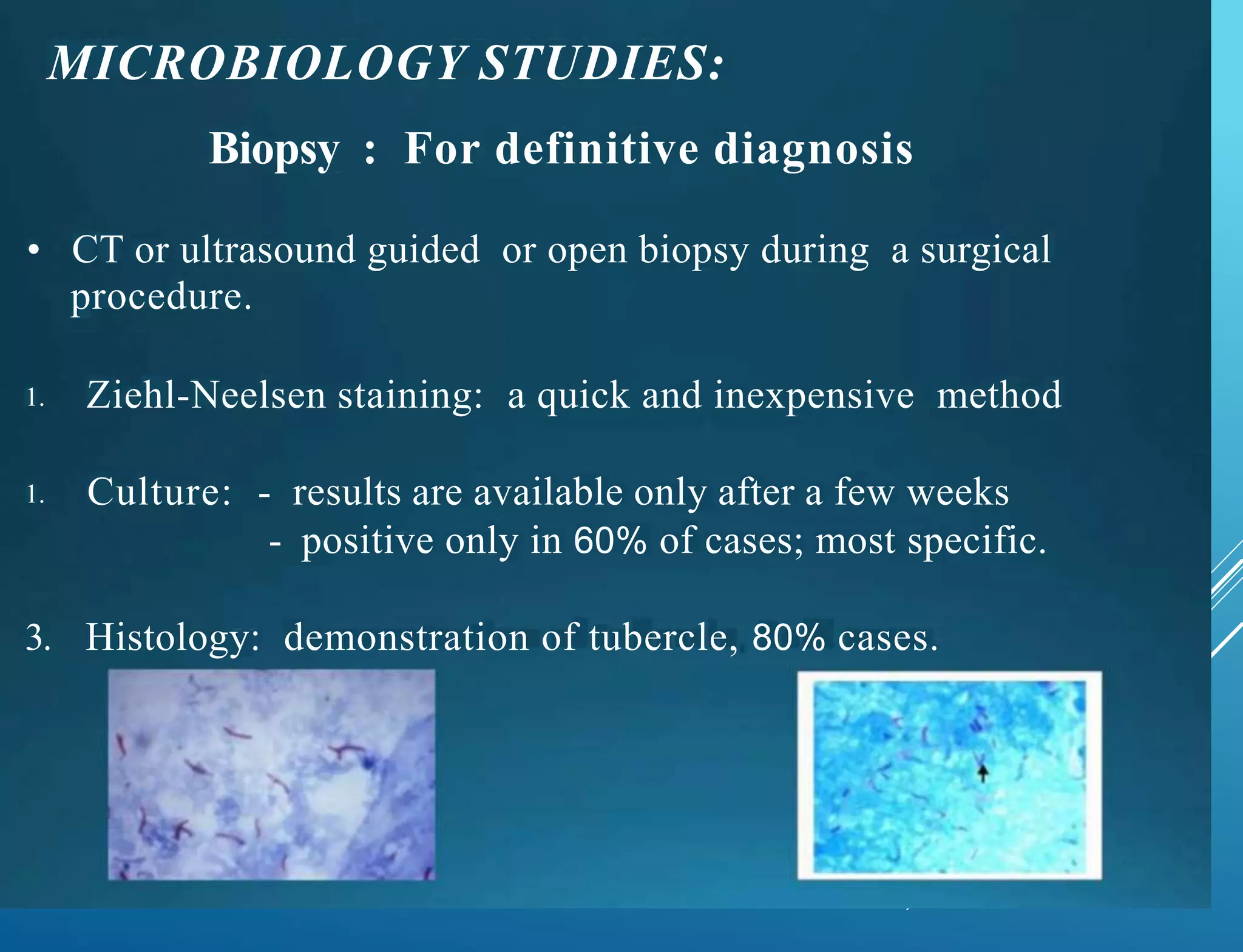 TB & fungal infection of the spine adnan al bannna | PPTX | Bone and ...