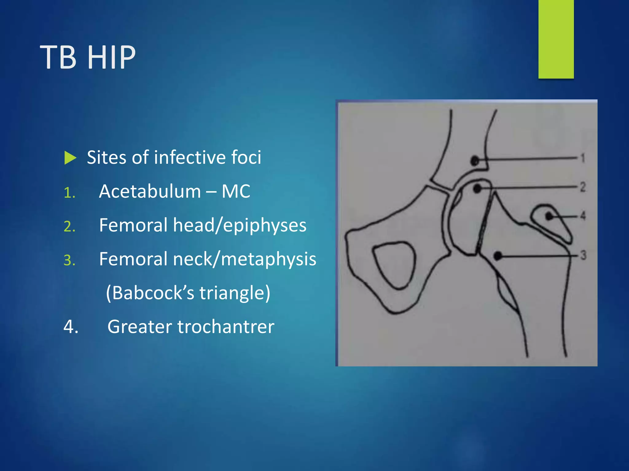 tb hip.pptx
