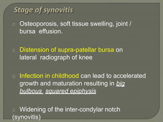 Tb hip knee shoulder dactylitis | PPTX