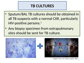 Tuberculosis HIV RVD Co-Infection Mx.ppt
