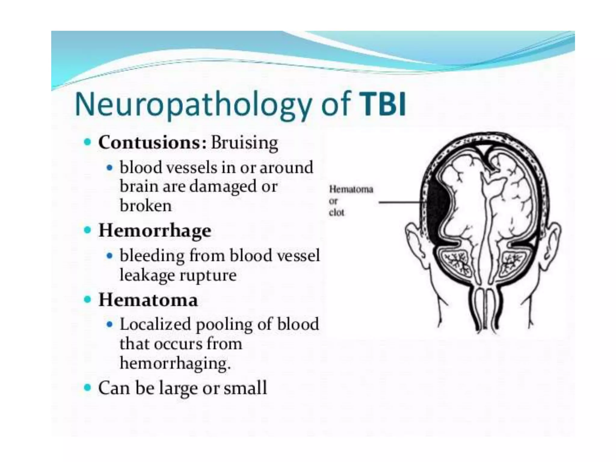 TBI (Traumatic brain injury ) | PPTX