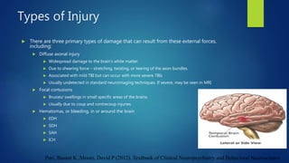 Traumatic Brain Injury | PPTX