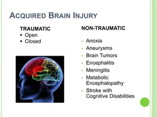 TBI.pptx