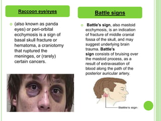 TBI.pptx | Death, Injury, or Military Conflict | Sensitive Topics