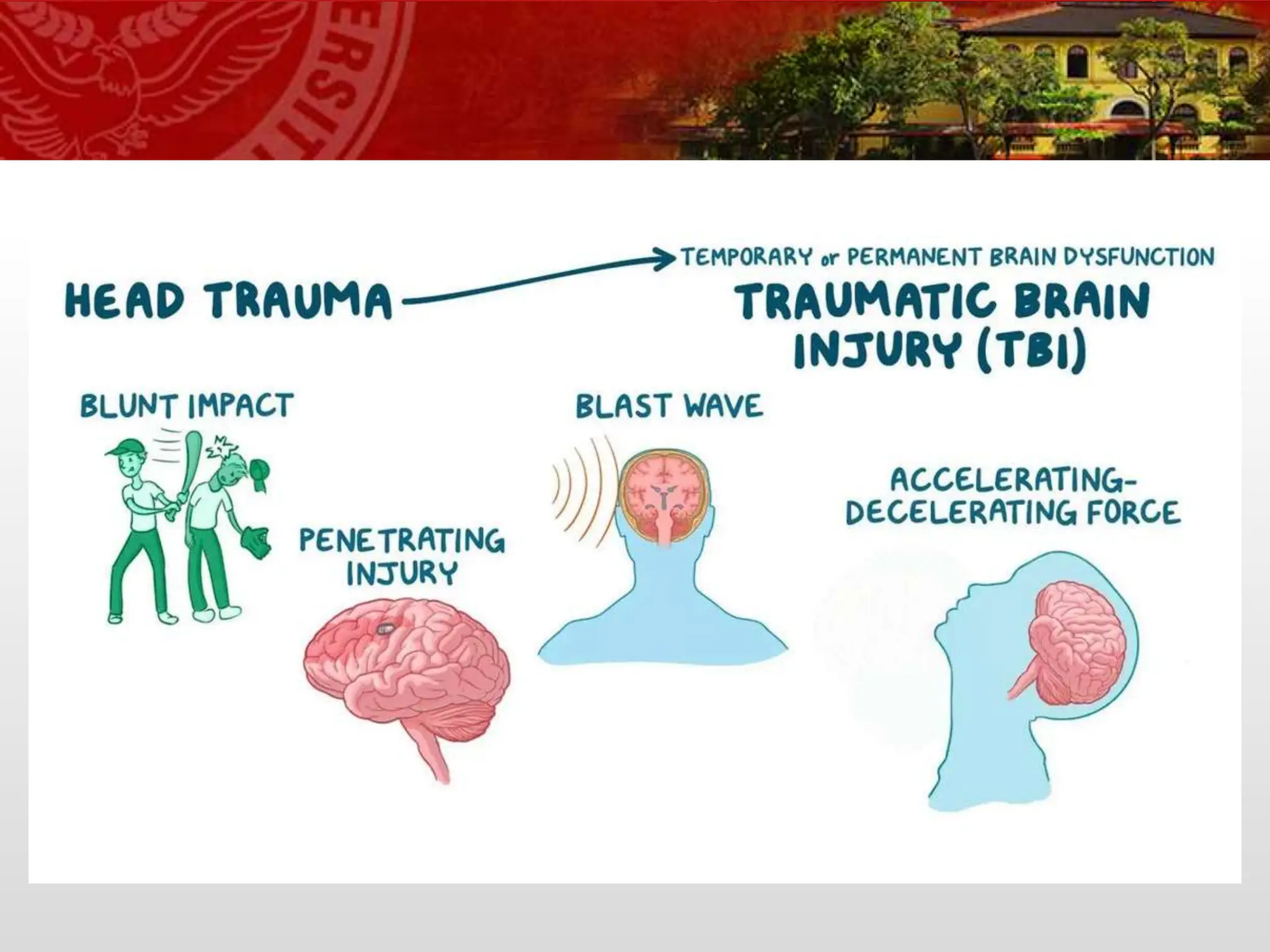 Traumatic Brain Injury(TBI) based on IDEA.pptx.pptx