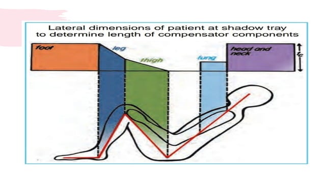 TBI.pptx total body irradiation radiotherapy | PPTX