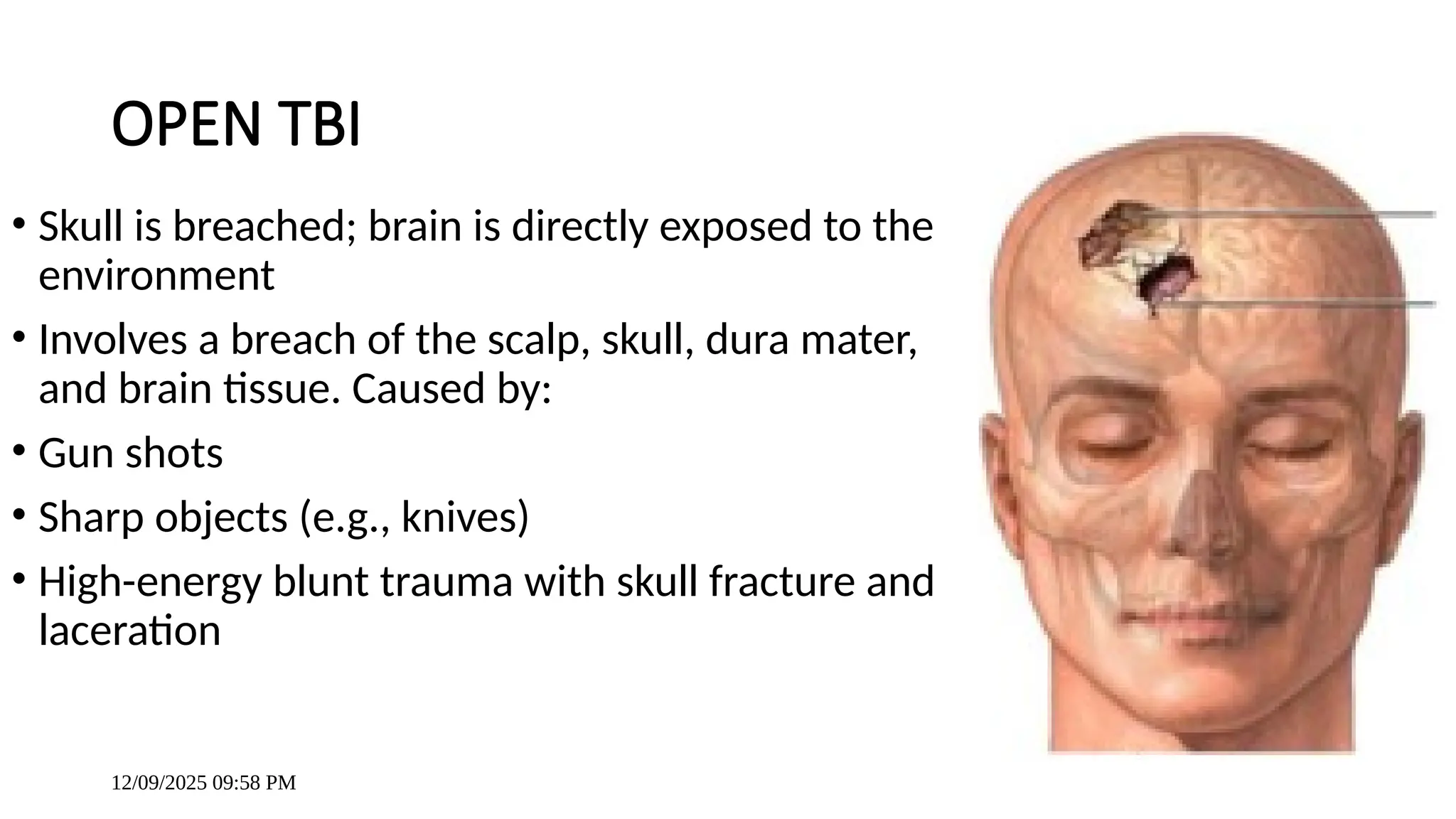 TBI- GROUP A, Subgroup 1.pptxeeeeeeeededr | PPTX